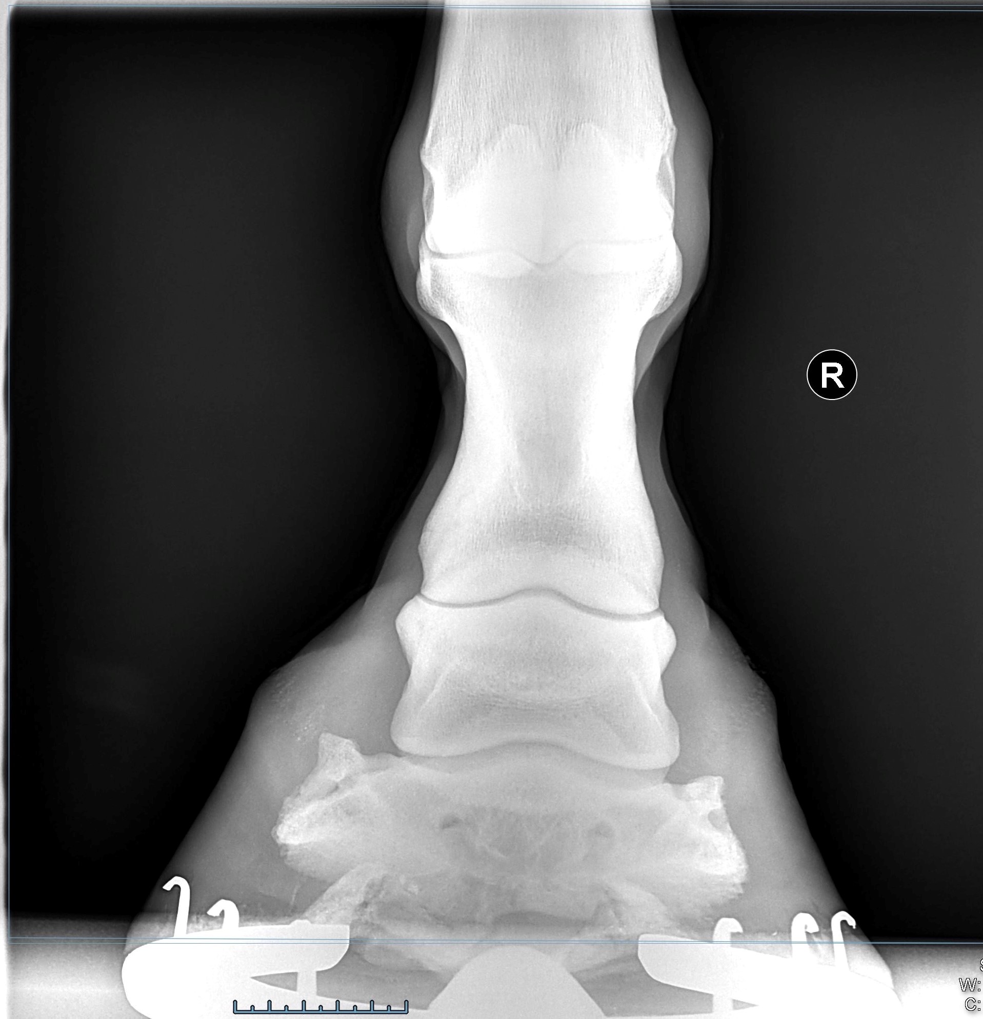 Wireless portable endoscope, x-ray and ultrasound, with stall-side ...